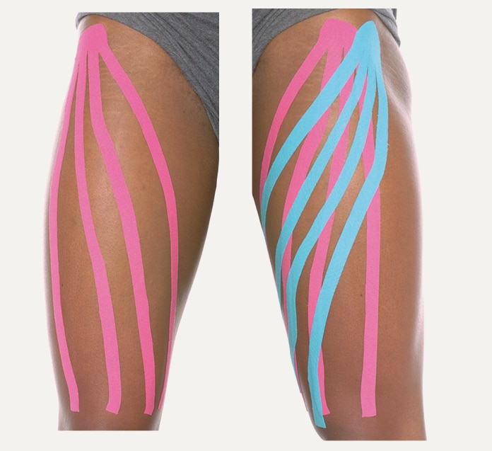 Kinesio Taping Of Superficial Lower Extremity Lymphatic Pathways Kinesio